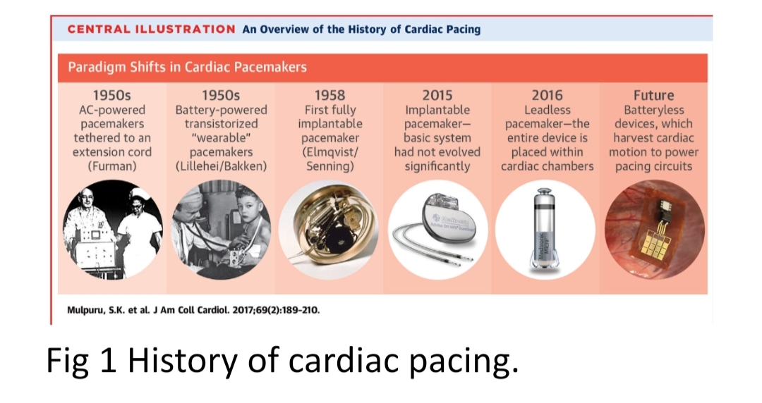 A New Era in Cardiac Pacing: Lead to Leadless- Implantation of the ...